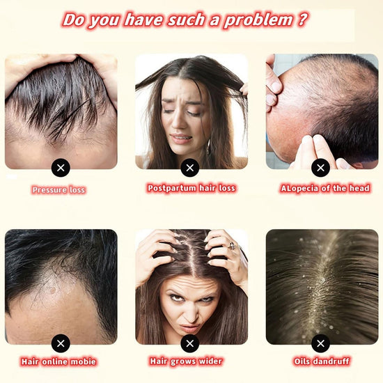 ANTI-HAIR LOSS HAIR SHAMPOO Black What Spirit (Pack of 2) – MaxSmile